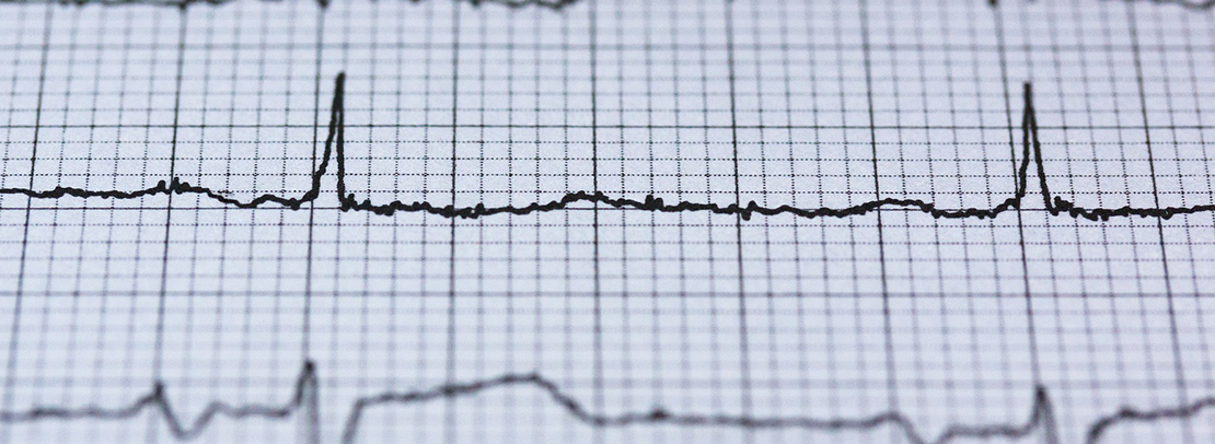 ACC-Turbo mitigates pulse-wave DDoS attacks using programmable switches ...